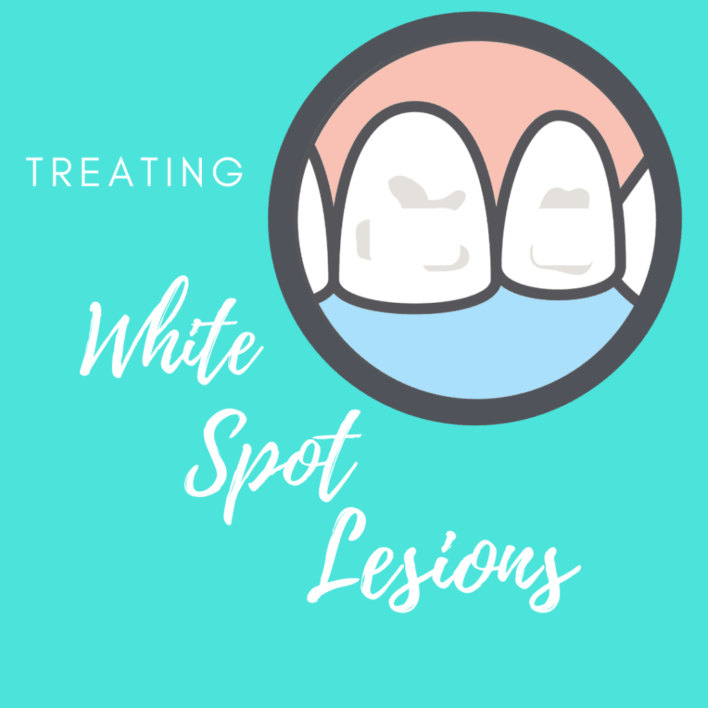 Treating White Spot Lesions 8812